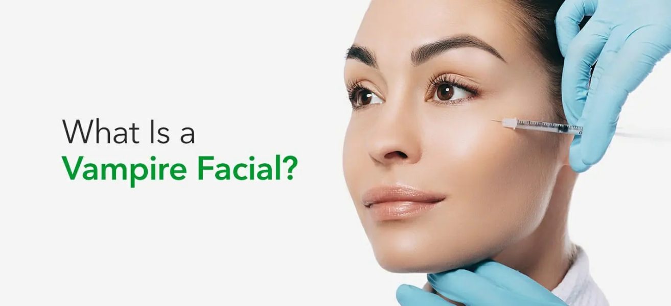 What is a Vampire Facial | How does it Help?
