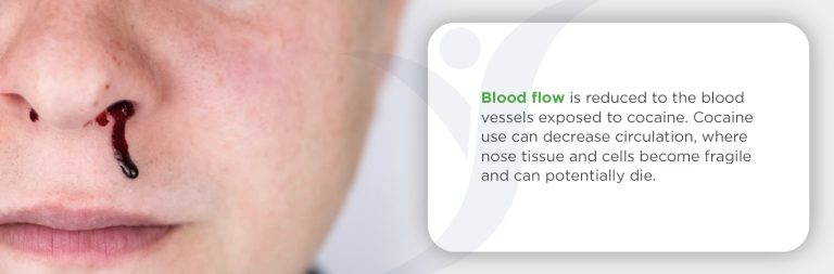 Snorting Drugs and Signs of Nose Damage - Synergy Wellness