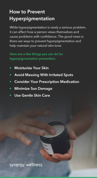 Hyperpigmentation: What Is It and Can It Be Treated? - Synergy Wellness