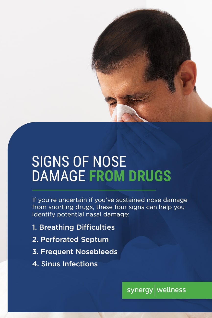 Snorting Drugs and Signs of Nose Damage - Synergy Wellness