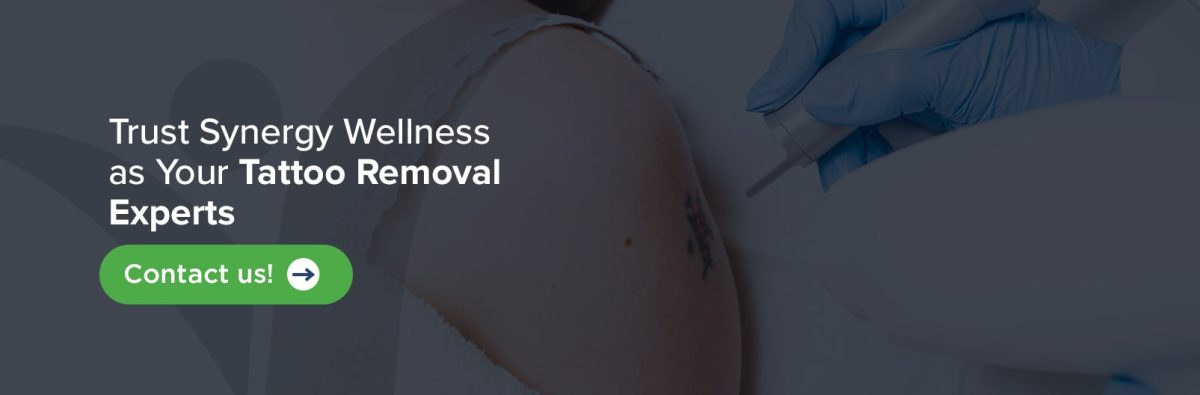 Can Lasers Make Your Tattoo Disappear Completely? - Synergy Wellness